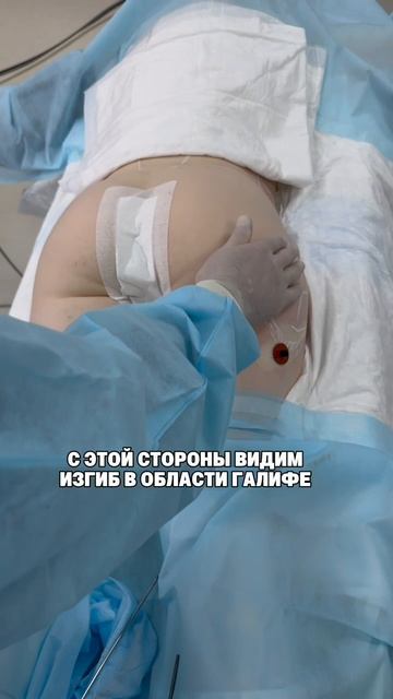 #комплексная_операция: стремление к безупречности