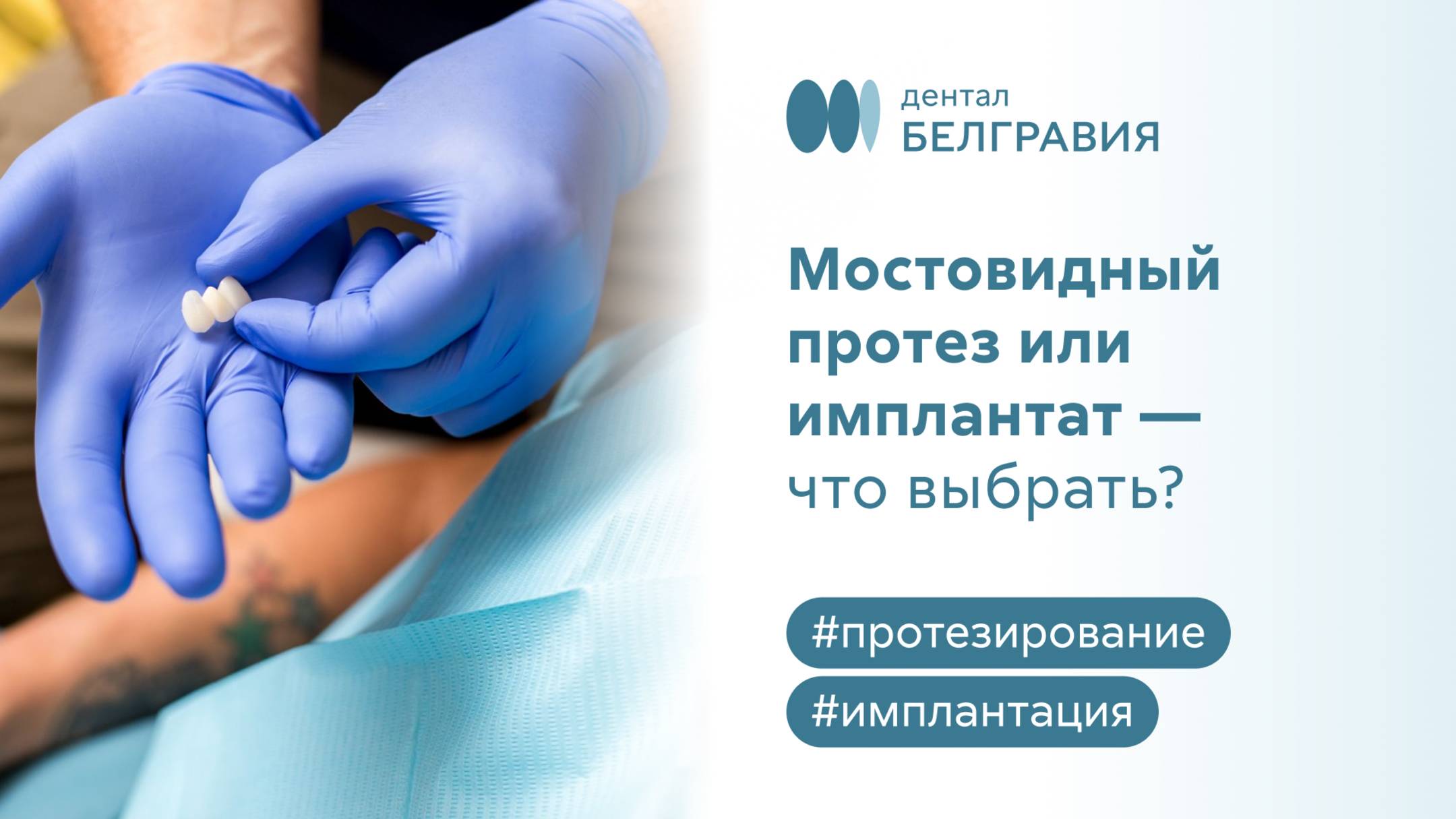 Мостовидный протез или имплантат - что выбрать?