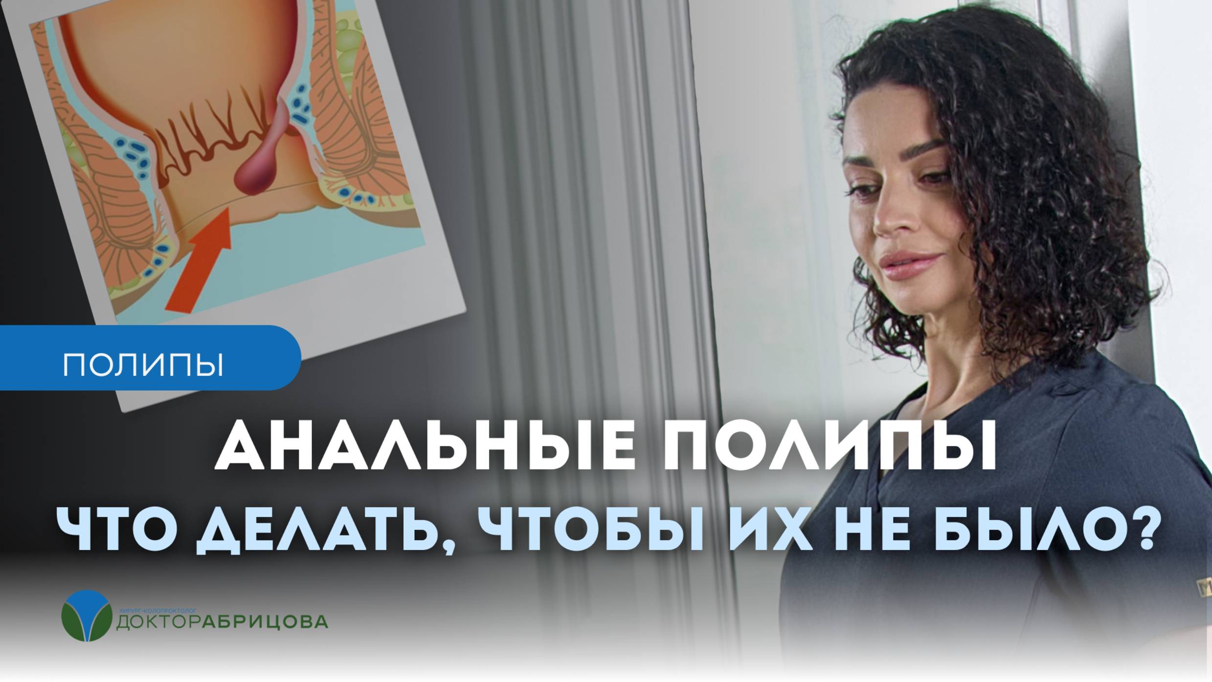 Фиброзные полипы анального канала чем отличаются и нужно ли их лечить
