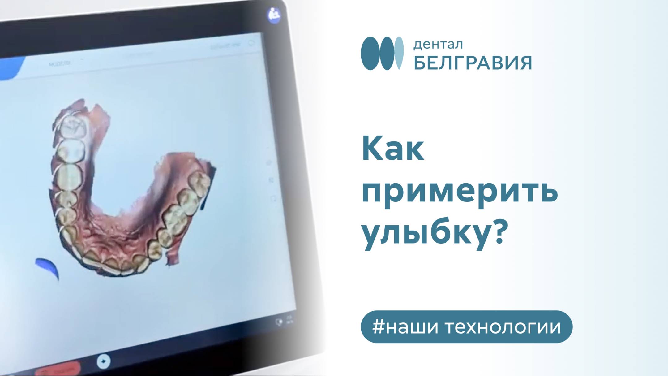 Как примерить улыбку?