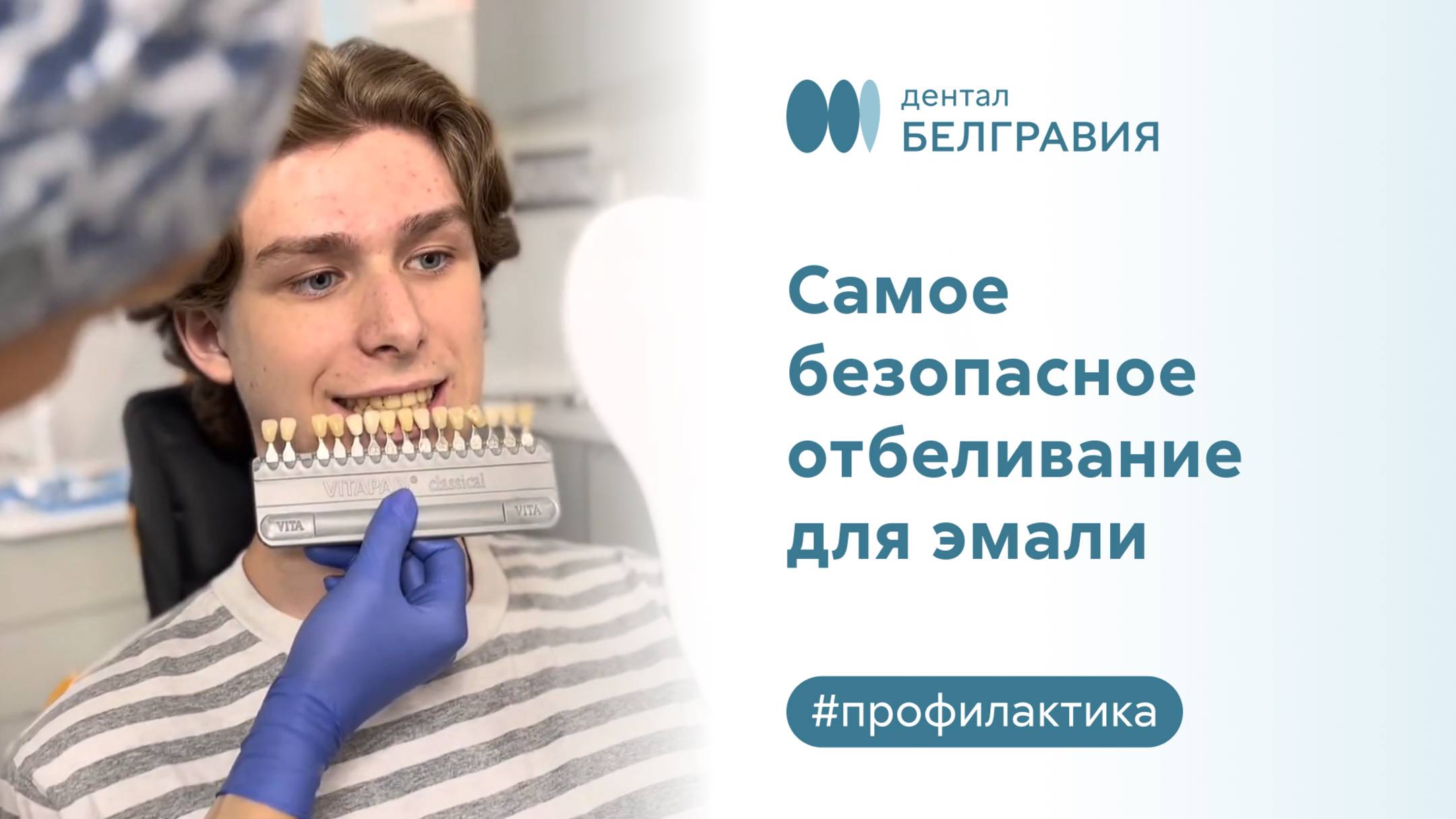 Самое безопасное отбеливание для эмали