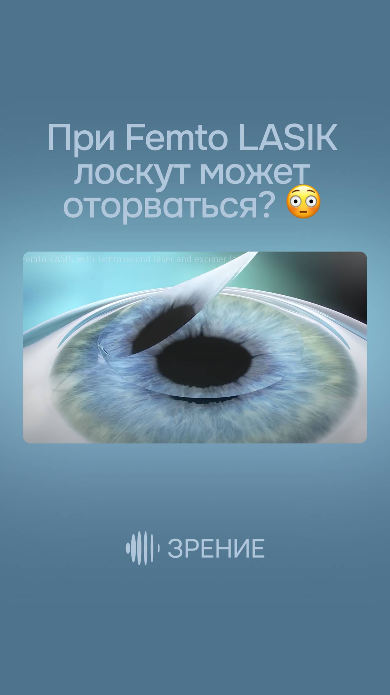 При ФемтоЛасик лоскут может оторваться?