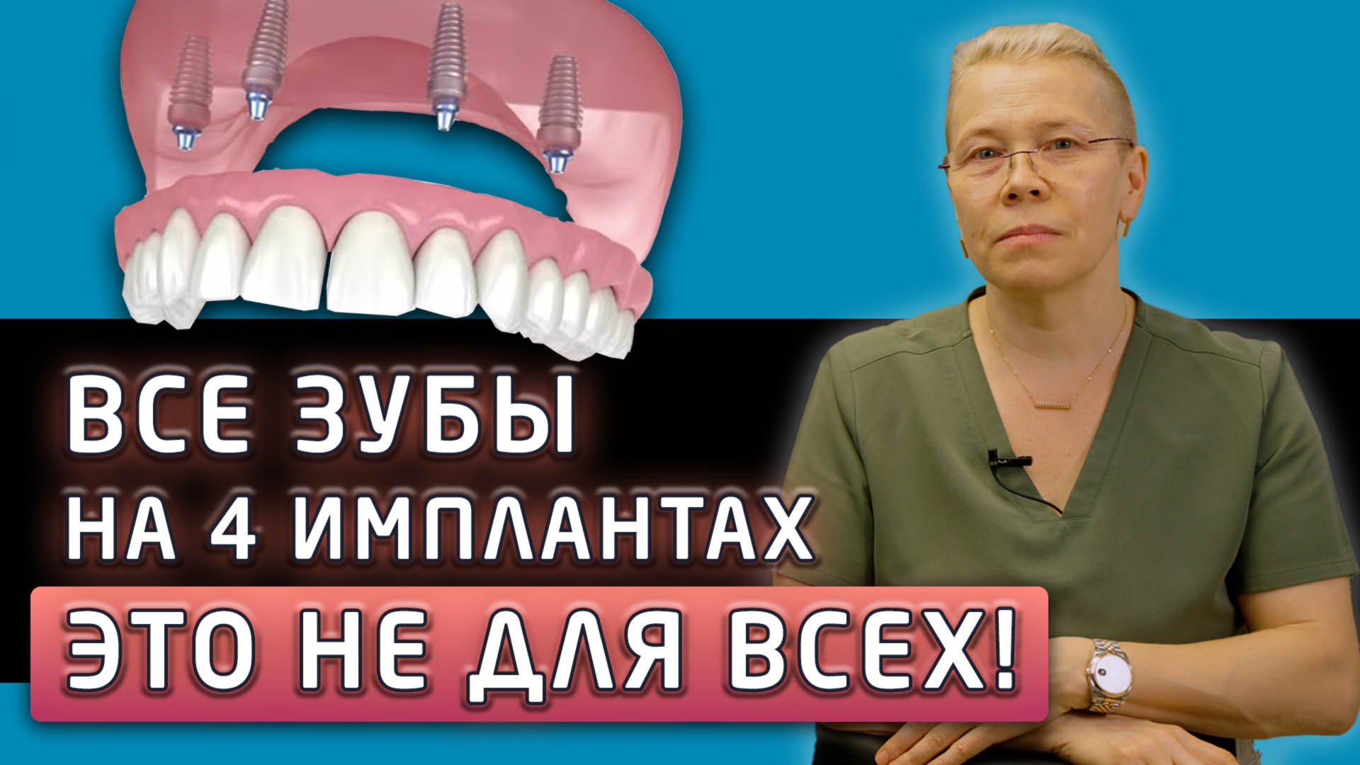 ПРО ЭТО МАЛО КТО ГОВОРИТ! Почему концепция все на 4 имплантах подходит не всем пациентам?