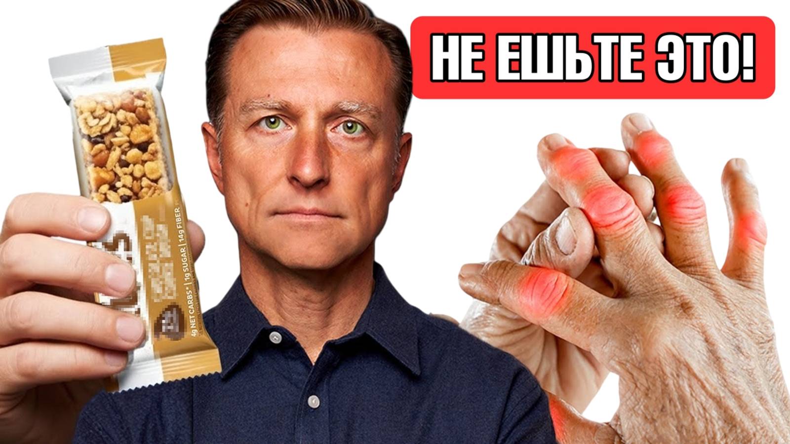 Откажитесь от этих 7 продуктов при артрите и боли в суставах