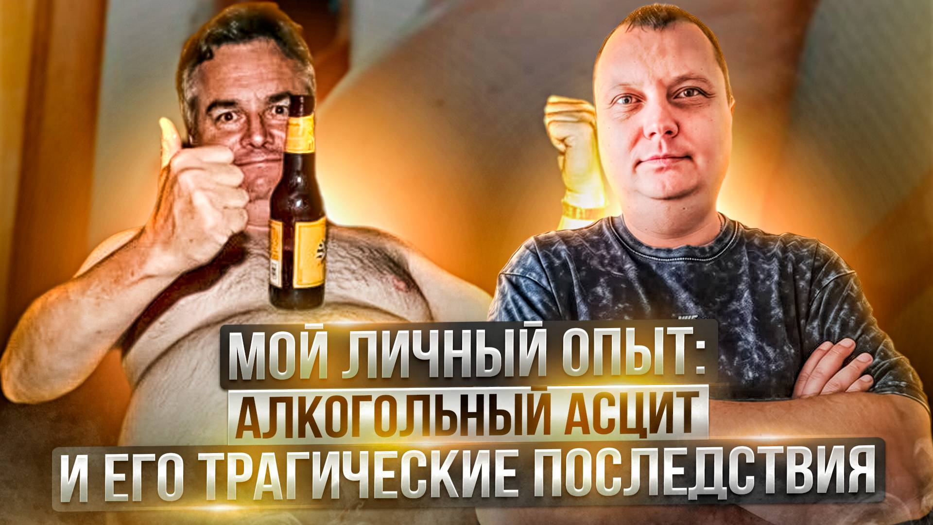 Алкогольный асцит и его трагические последствия - Мой личный опыт