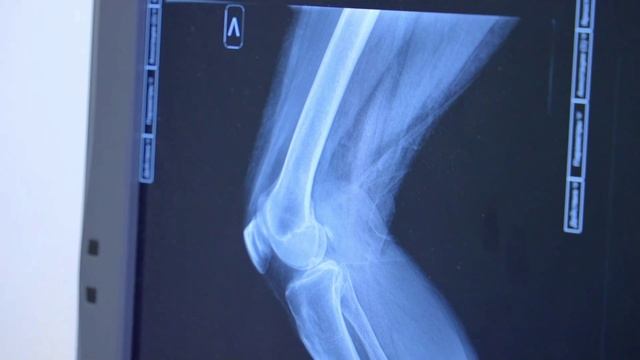 Знакомьтесь, врач! - травматолог Екатерина Морозова