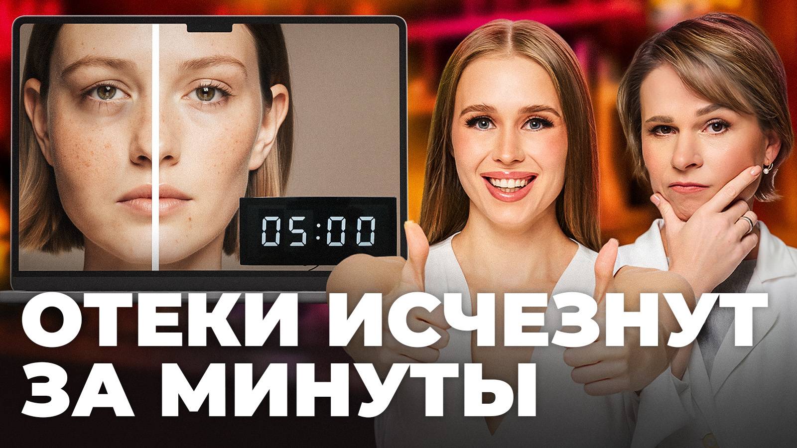 Как убрать отеки с лица? Простые и рабочие способы! Проверяем советы блогеров