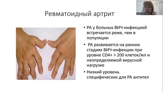Особенности течения ревматических заболеваний на фоне ВИЧ-инфекции