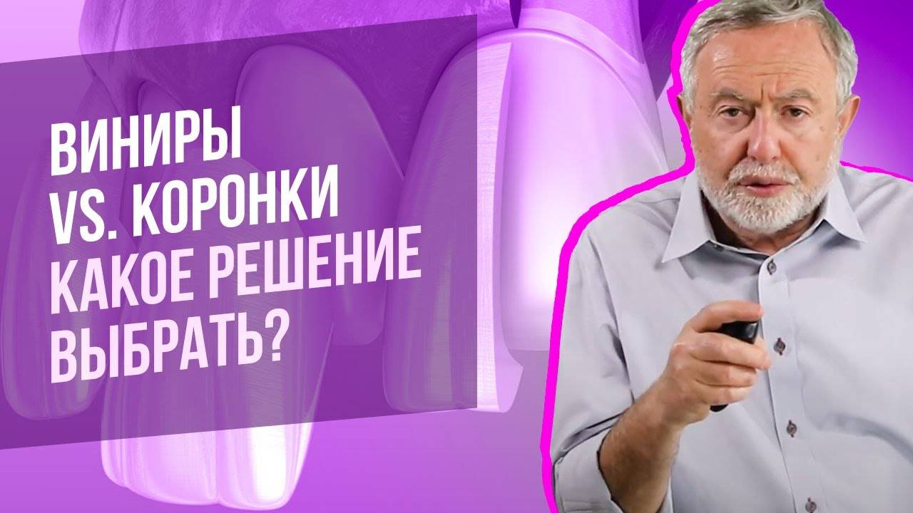 Красота передних зубов. Виниры или коронки?