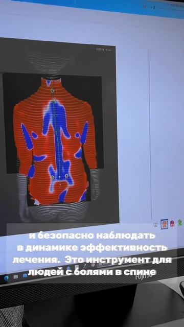 DIERS диагностика без рентгеновского облучения! ЛД Медицина +79265202126