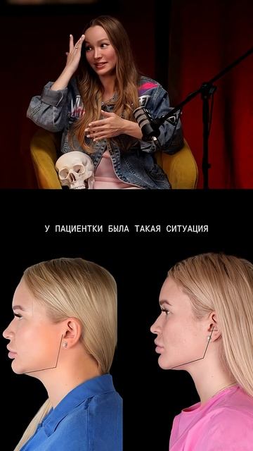 Одна из причин появления второго подбородка  подкаст доступен к просмотру на канале Smile Gallery