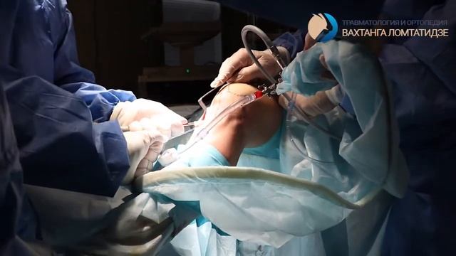 Повреждение передней крестообразной связки  Симптомы, диагностика, лечение, восстановление