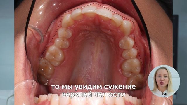 Тотальная реабилитация пациента - почему мы отказали в винирах?