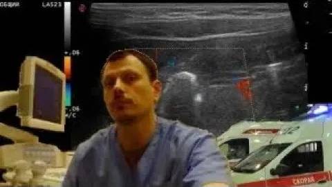 Детское УЗИ желудка - Язва препилорического отдела желудка