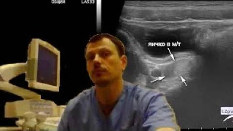 Детское УЗИ брюшной полости - Абдоминальная форма крипторхизма на УЗИ