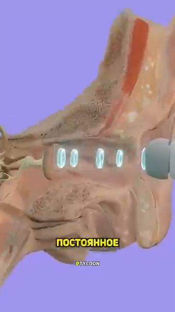 НАУШНИКИ УБИЙЦЫ