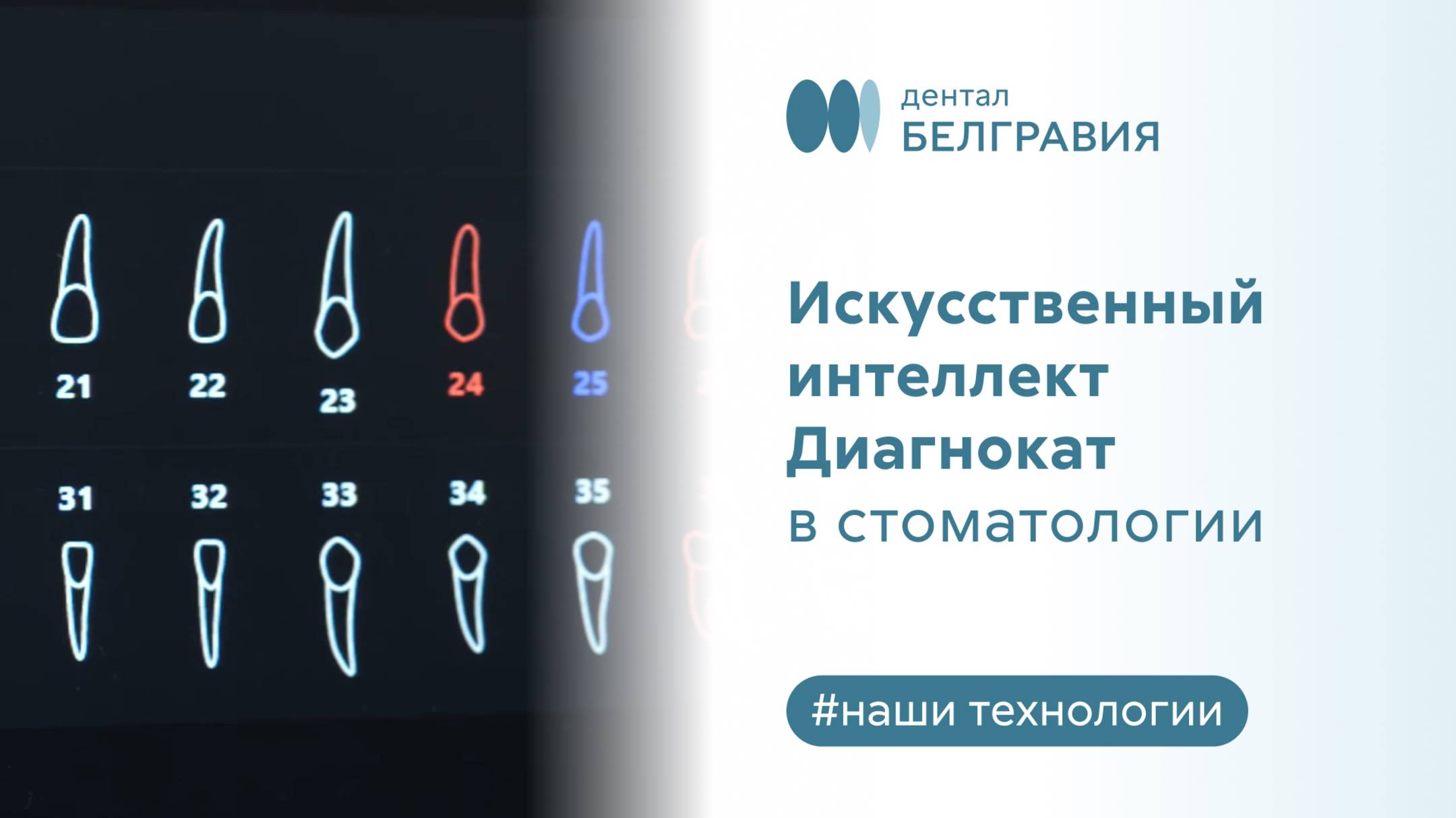 Искусственный интеллект Диагнокат в стоматологии Belgravia Dental Studio