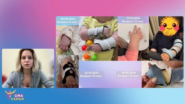 Подходы к работе с двигательными нарушениями при СМА: физическая терапия