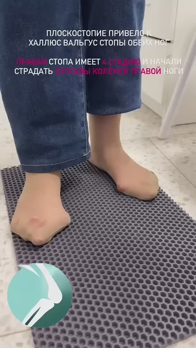 ЛД Медицина лечение вальгуса стопы