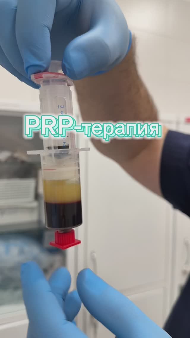 PRP-терапии — обновление тканей. ЛД Медицина + 7 926 520 21 26 ЖУК/ МСК