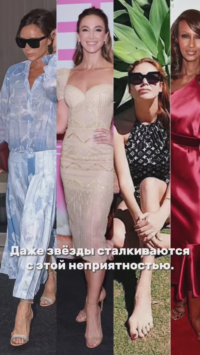 Лечение стопы вальгусная деформация (шишка) первого пальца стопы +7 926 520 21 26 Жуковский, Москва