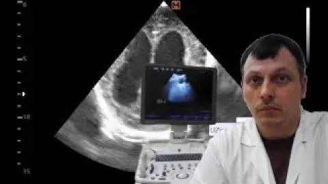 Детское УЗИ головного мозга (нейросонография) и брюшной полости - Двойня - ВЖК