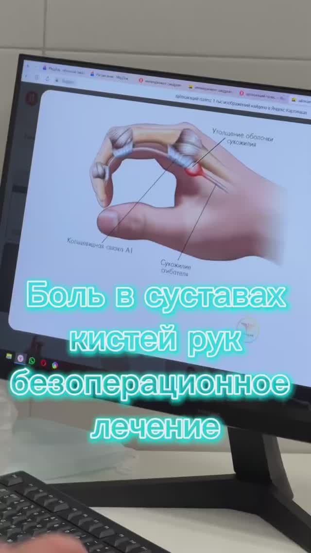 Боль в суставах кисти рук - хирургия или альтернатива? ЛД Медицина