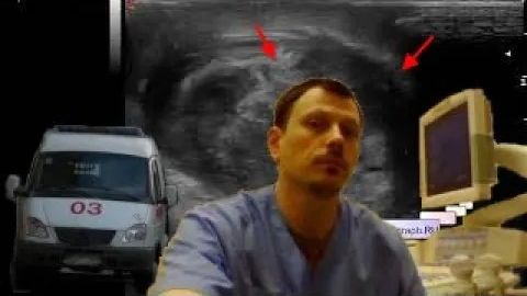 Детское УЗИ мягких тканей - Повторная паховая грыжа