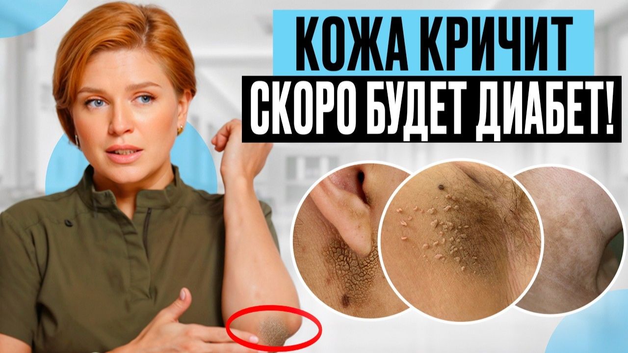 Все время устаешь САХАРНЫЙ ДИАБЕТ можно предотвратить!