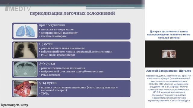 Доступ к дыхательным путям при повреждении головного мозга Щеголев А.В. 2025