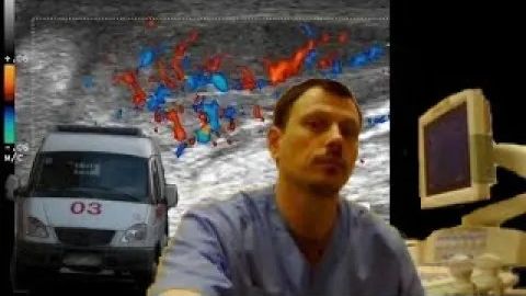 Детское УЗИ мошонки - Фибринозный эпидидимит