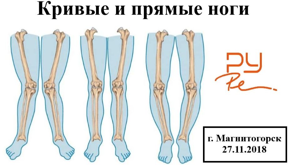 Лекция 9. Прямые и кривые ноги