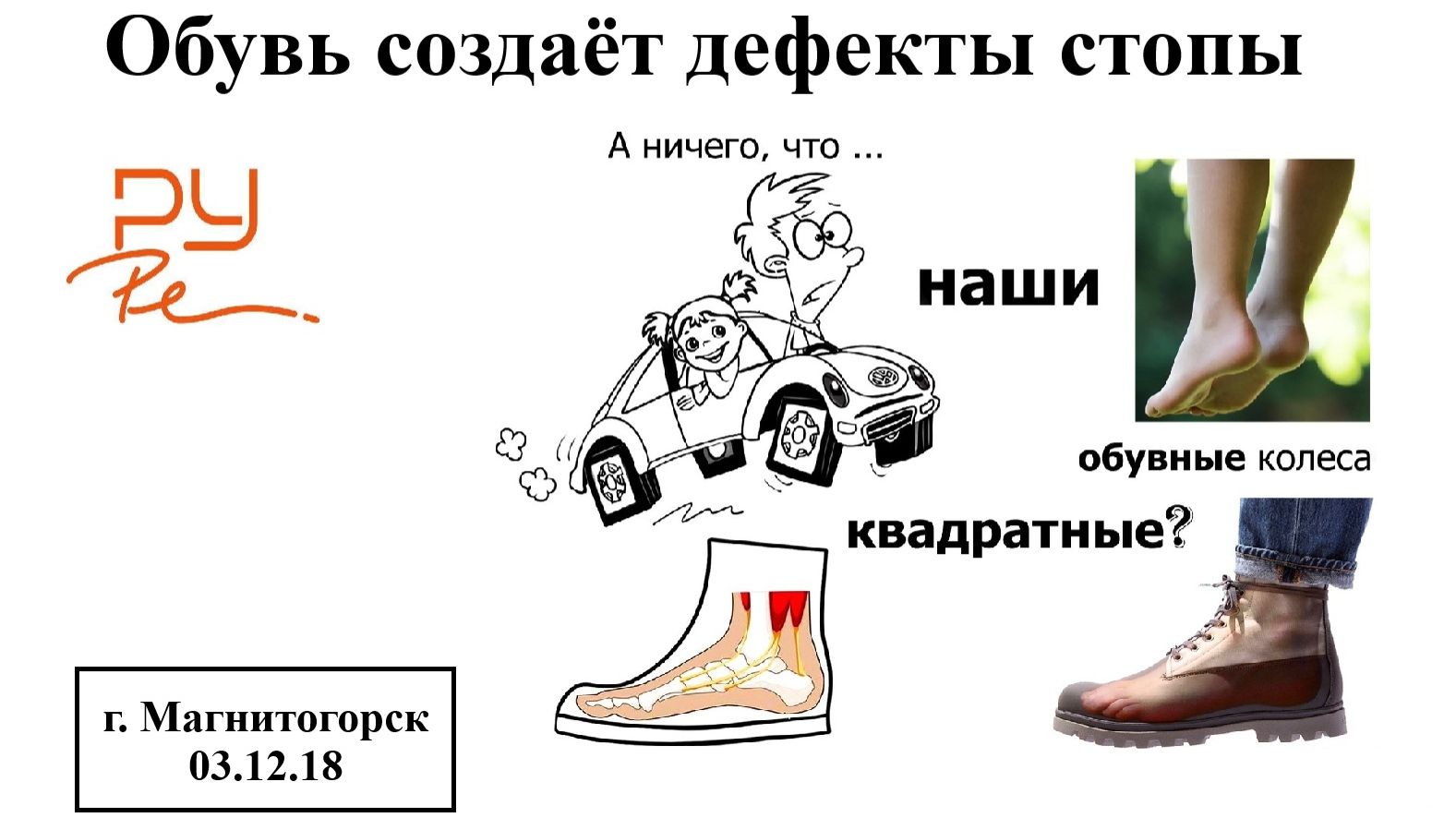 Лекция 10. Обувь создаёт дефекты стопы