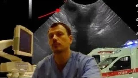 Детское УЗИ мягких тканей - Двухсторонний парапроктит