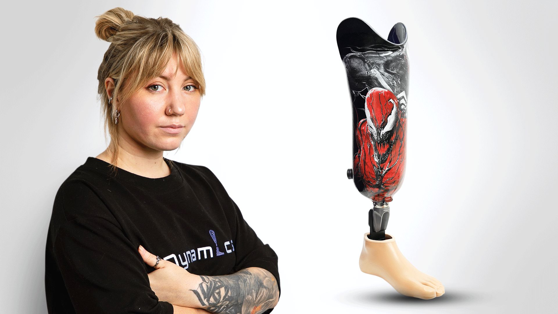 Физическая активность во время протезирования. Открытый урок с реабилитологом