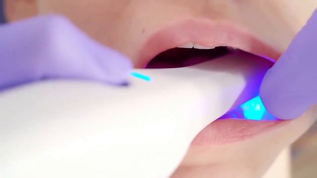 Сканер Medit i500 Вилана Дент