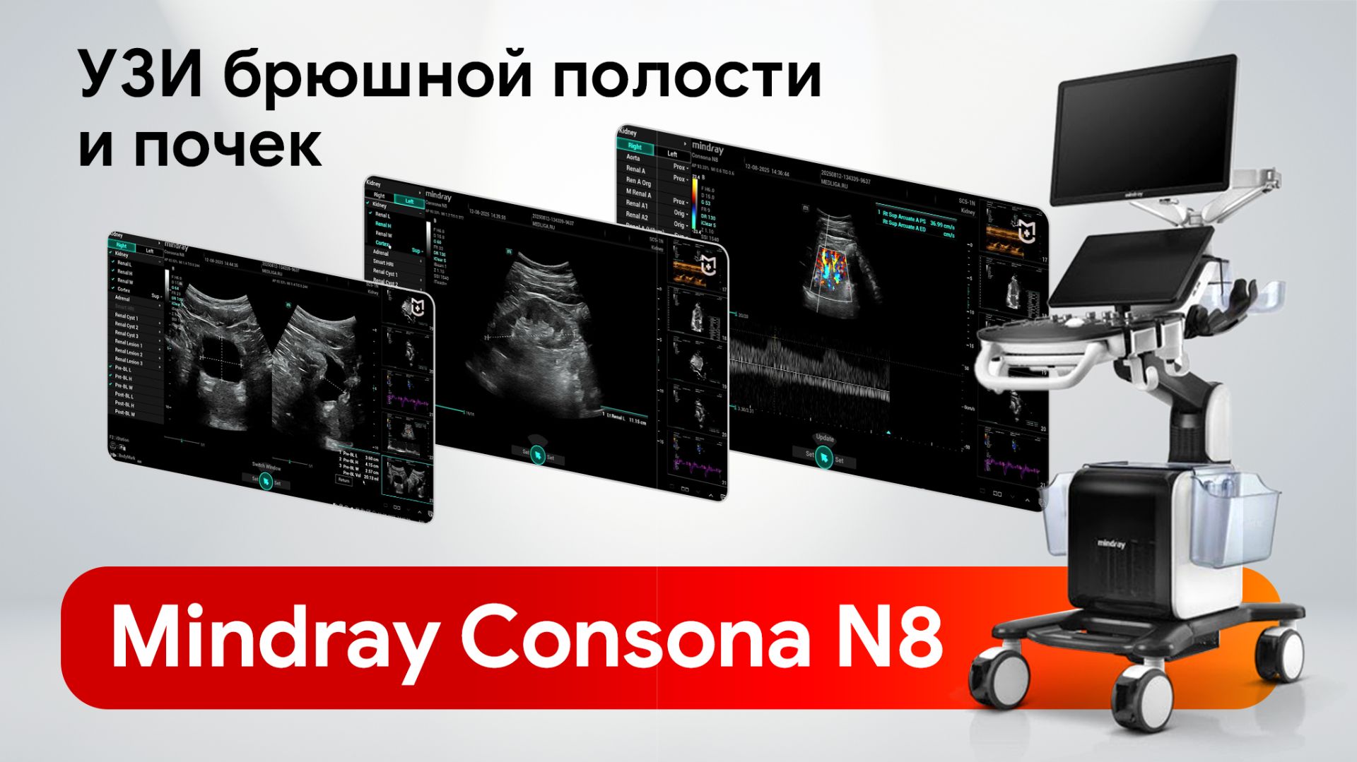 УЗИ брюшной полости и почек: Mindray Consona N8 в реальной работе
