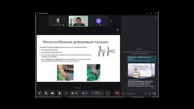 18.11 | Врач-ортопед: Венер Валиев | Деформации пальцев стопы: что нужно знать подологу