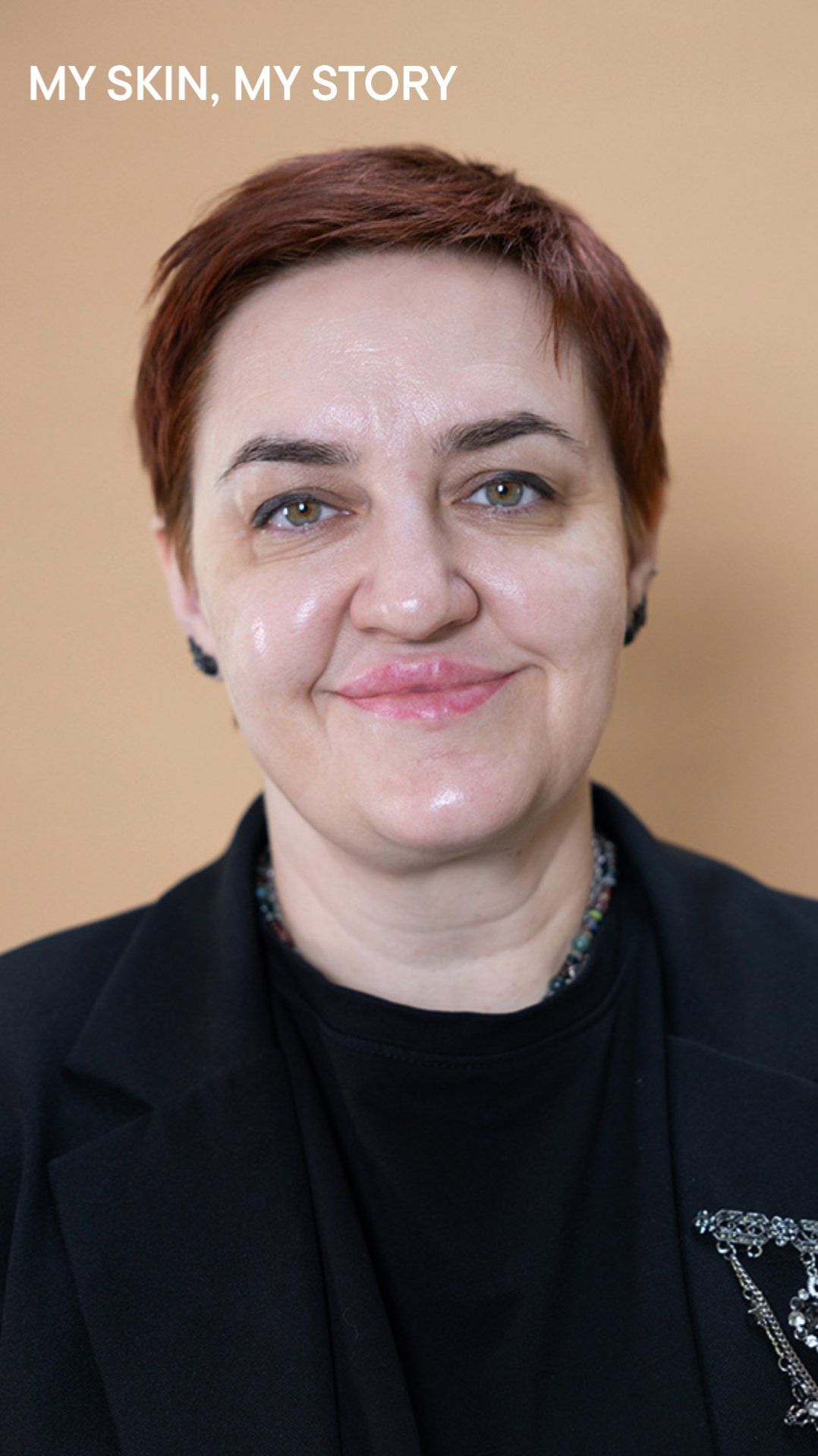 BABOR_MY SKIN, MY STORY: Екатерина — пигментация, отёчность и потеря упругости кожи