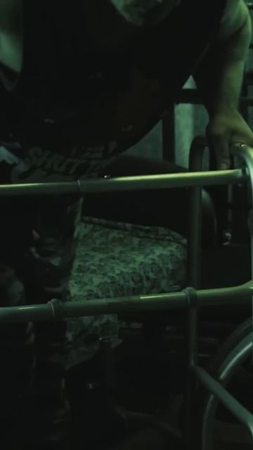 Вырвал прямую кишку | Инвалид после пьянки #алкоголь #история #запой