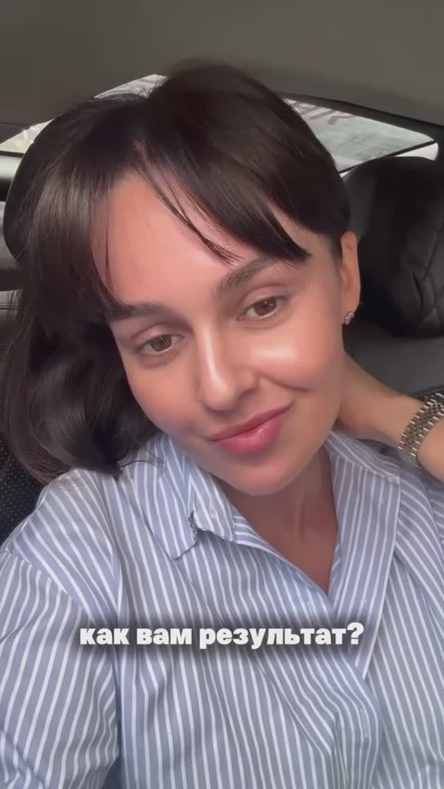 Пациентка в 32 года обратилась с запросом на лёгкость и свежесть во взгляде