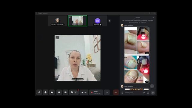 20.11 | Куратор: Елена Беликова | Почему важно применять фотодинамическую терапию при ранах