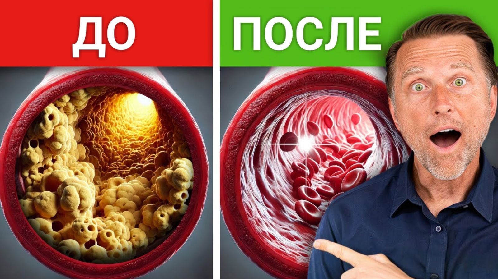 Блюдо №1 для предотвращения инфаркта и инсульта