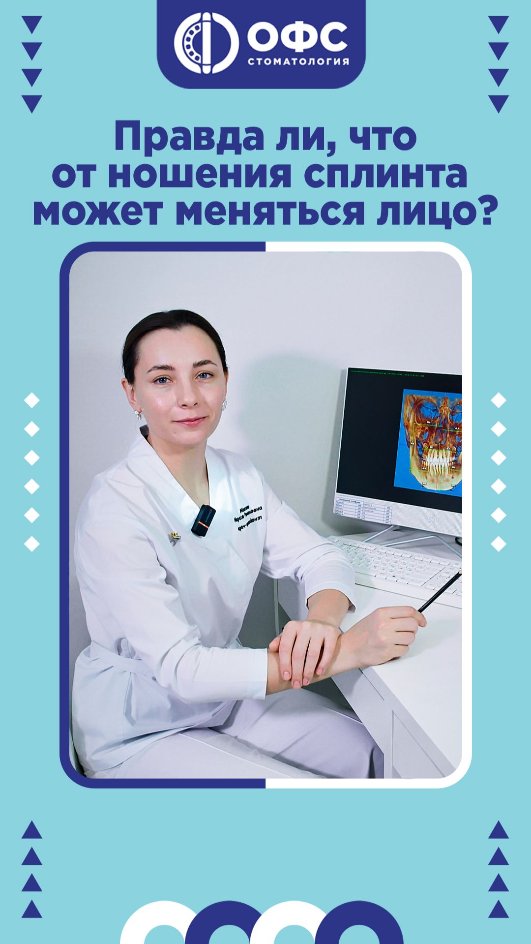 Правда ли, что от ношения сплинта может меняться лицо?
