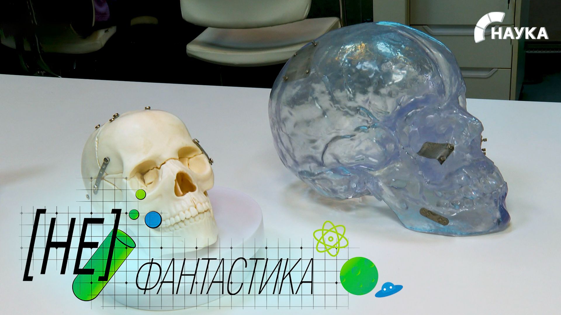 Импланты, которые растворяются. Как новая разработка российских ученых ускоряет регенерацию костей?