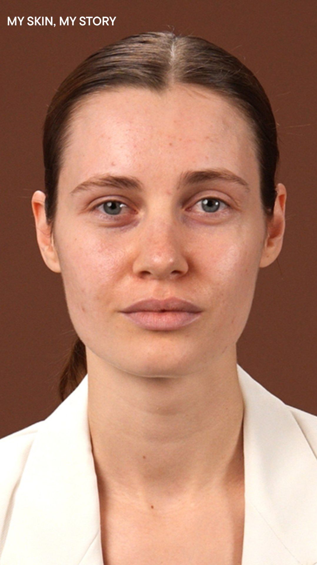 BABOR_MY SKIN, MY STORY: Валерия — результат борьбы с акне и неровным рельефом