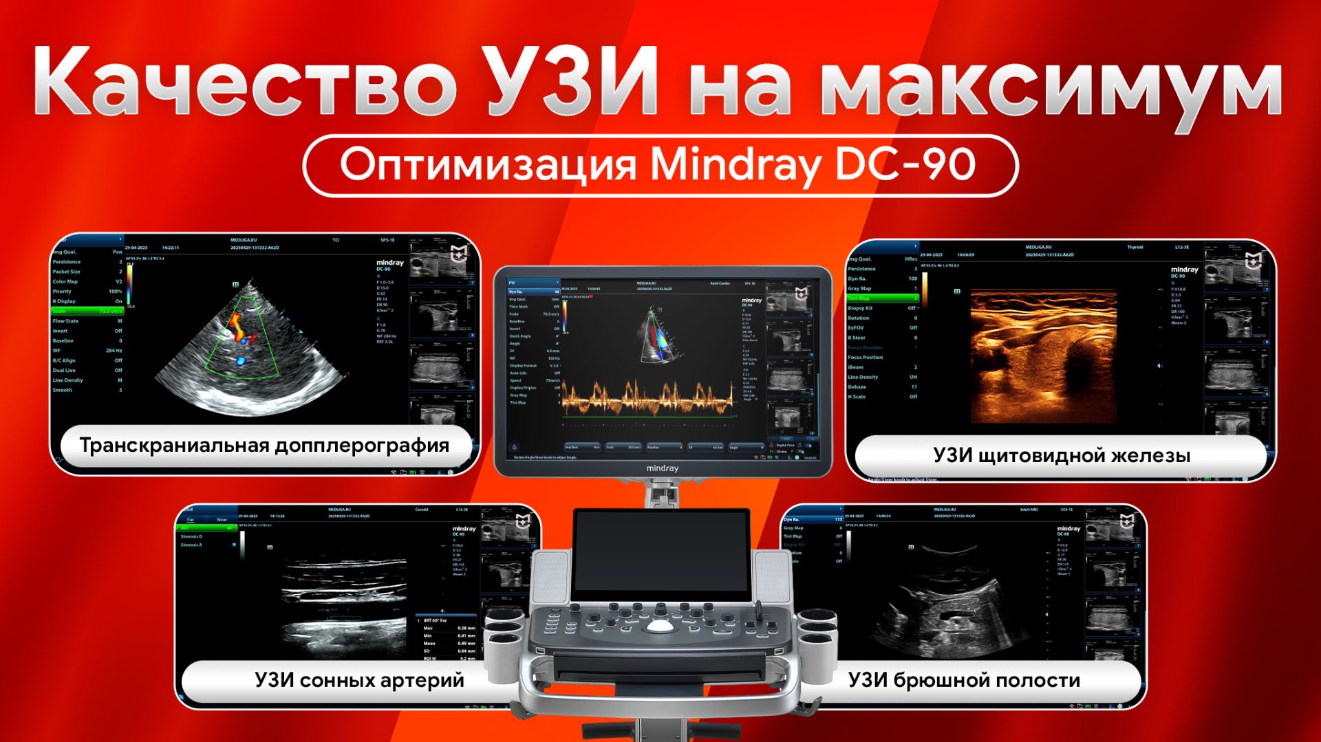 Как улучшить визуализацию на Mindray DC-90: мастер-класс для врачей УЗИ