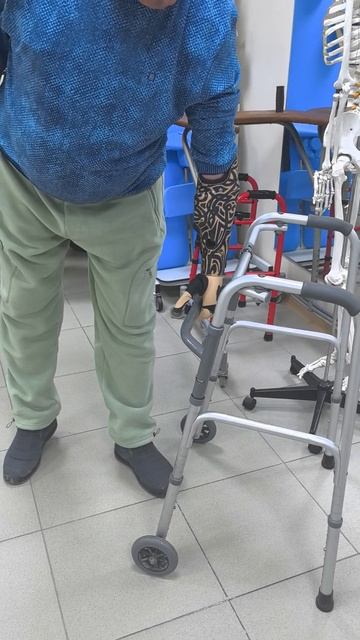 Протез предплечья с микропроцессорным управлением