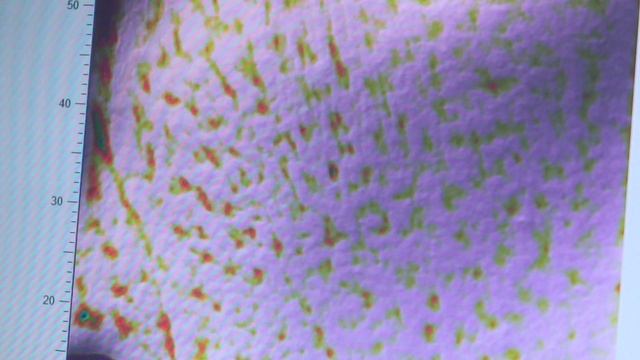 Консультация врача-косметолога. Челябинск