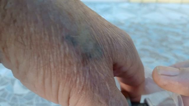 Строчный трансформатор. Убираю первичную обмотку.